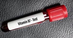 Biotin: A Supplement to Improve Overall Health